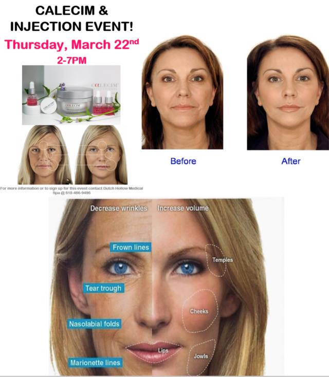 Dutch Hollow invites public to its Calecim and Versa Injection Event ...