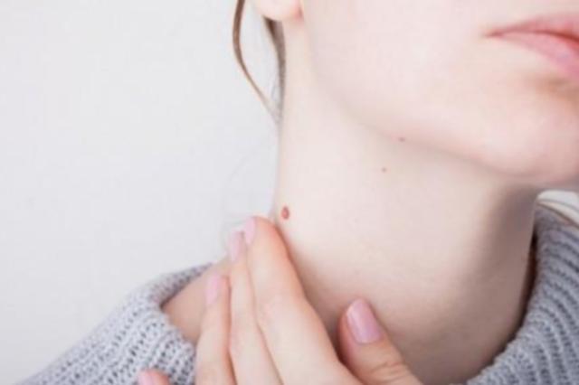 Winter Skincare Tips: Combatting Dryness and Cold Weather Damage ...